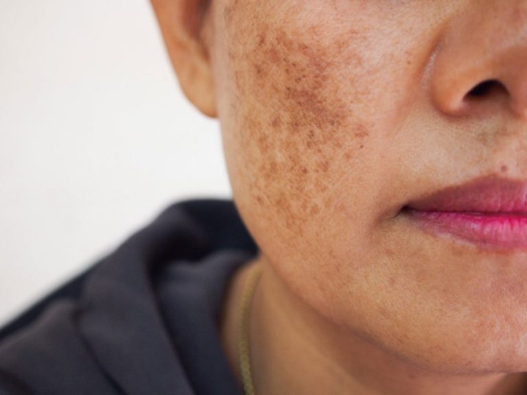Grace Knows: What Makes Vietnamese Skin Different?